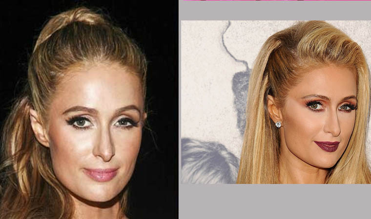 Famous foreign actors who are proud of their flaws - Page 4 of 8 ...